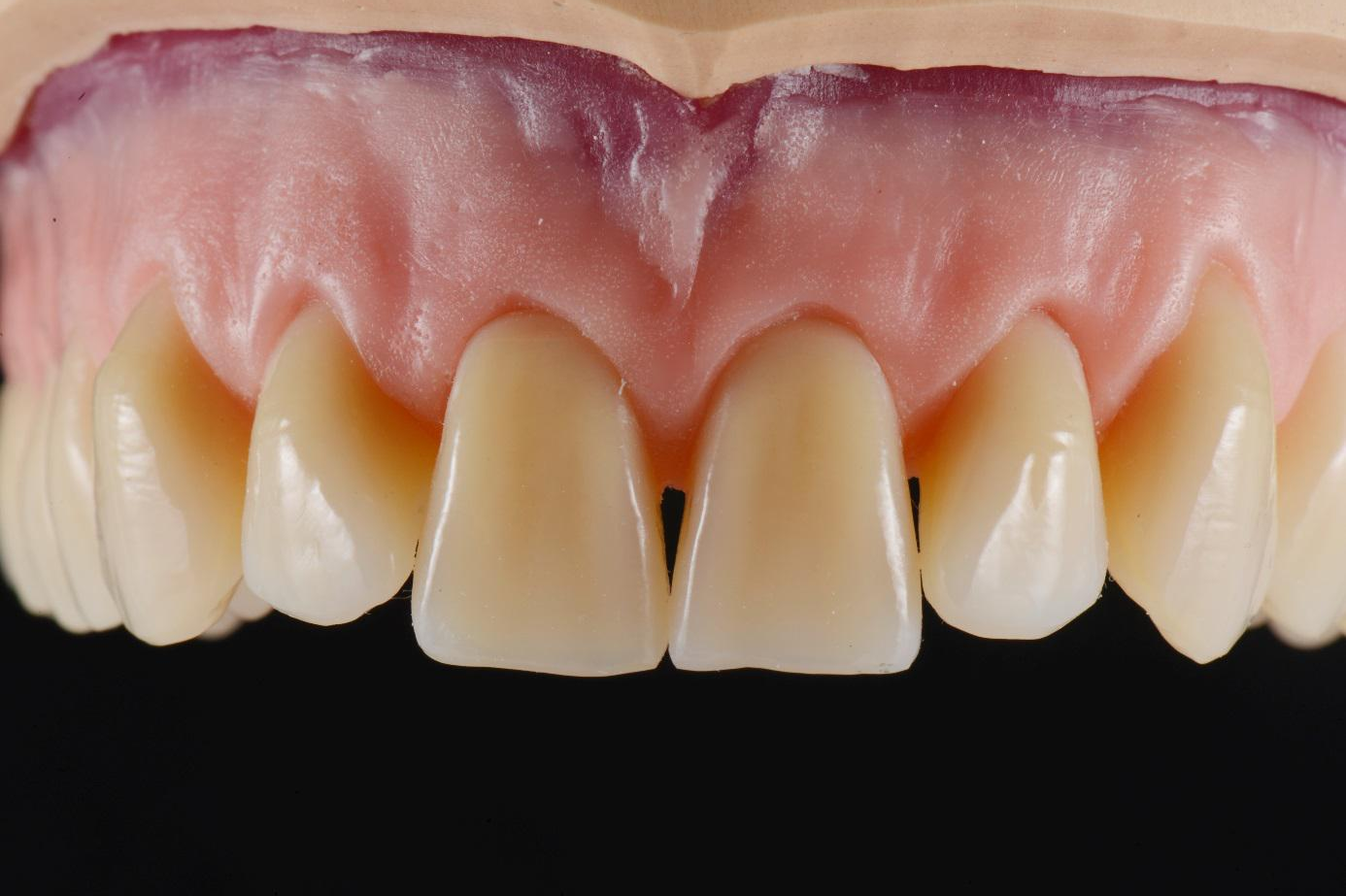 Total and partial denture waxes